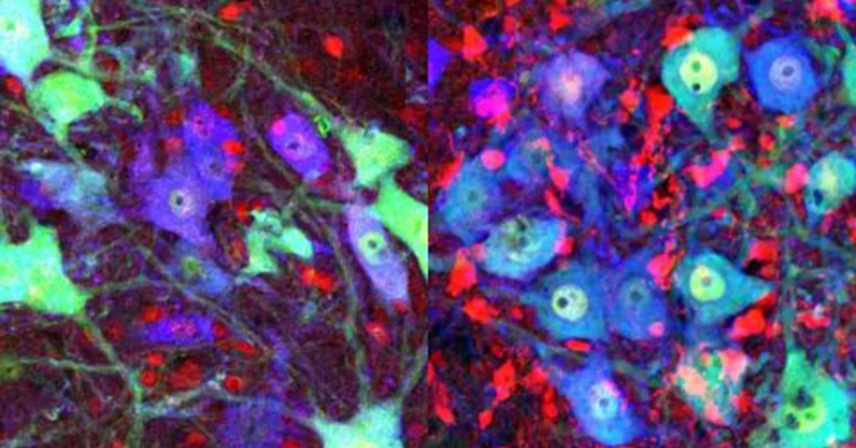 J Neuroscience paper online! | Butler Research Lab